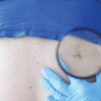 Skin Clinic - Devonport Health Centre